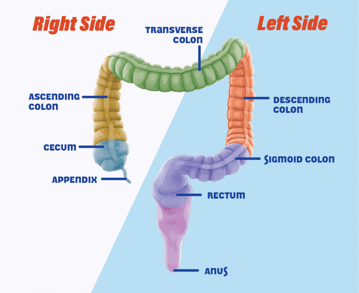 The Buzz About Sidedness: What Side Is Your Cancer On? | Fight CRC